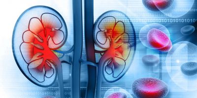 Rak nerki – objawy i leczenie – Nasz Senior